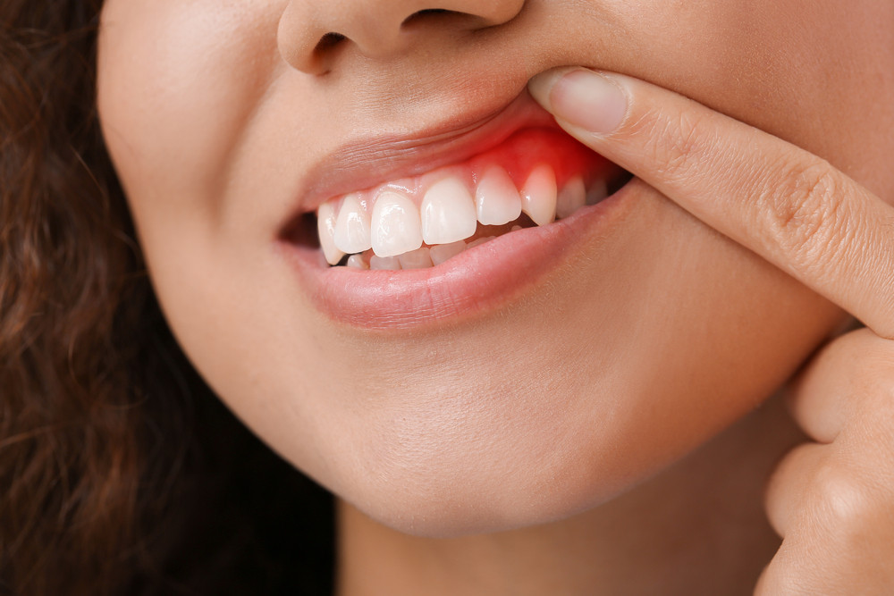 Understanding and Preventing Gum Disease: A Comprehensive Guide - HT ...
